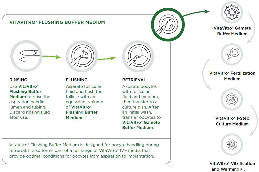 Printer Flushing Buffer at Annabelle Focken blog