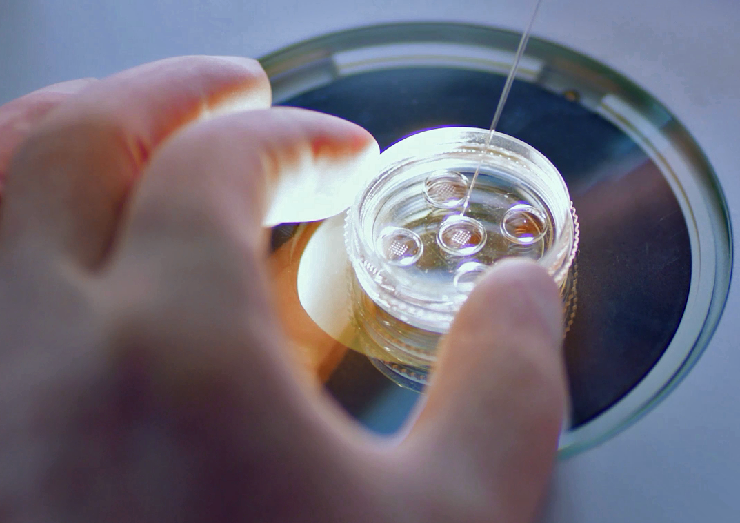 Exploring Micro-Well Culture: Creating an Optimal Growth Environment ...